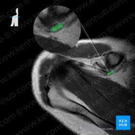 Akromioklavikulargelenk - Anatomie und Aufbau | Kenhub