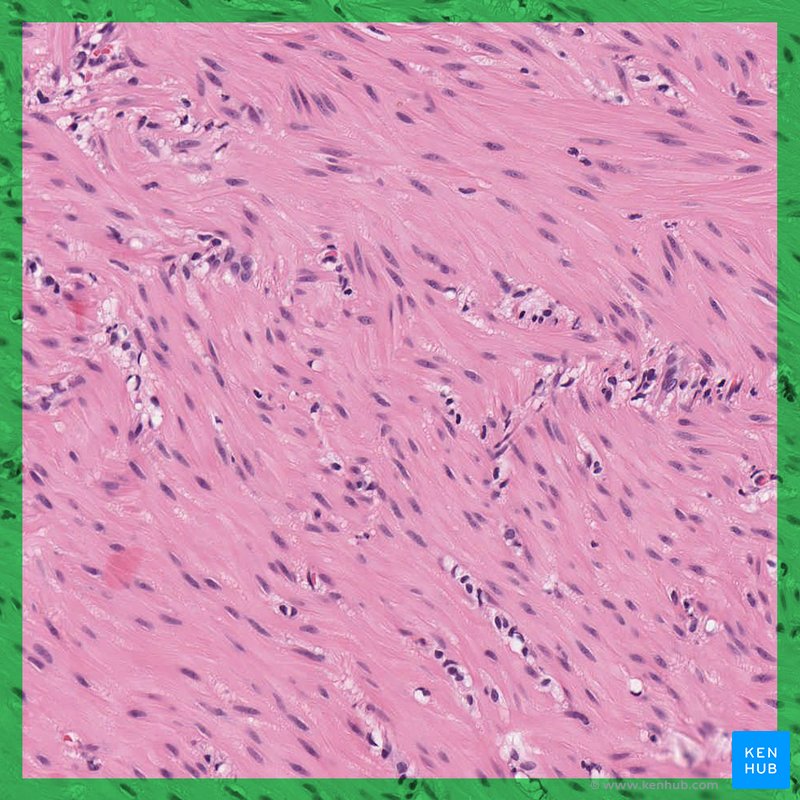 Tejido Muscular Liso Etiquetado TEJIDO MUSCULAR PLANTILLAS RESUELTAS