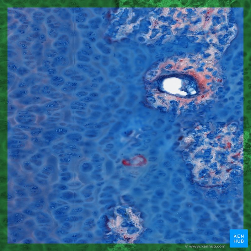 hyaline under microscope