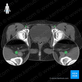 Femoral artery: Anatomy and branches | Kenhub
