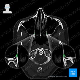 Palatine bone: Plates, borders, processes, articulations | Kenhub