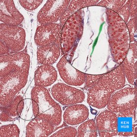 Fibroblast: Histological structure and function | Kenhub