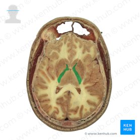 Capsula interna - Anatomie, Schenkel & Klinik | Kenhub