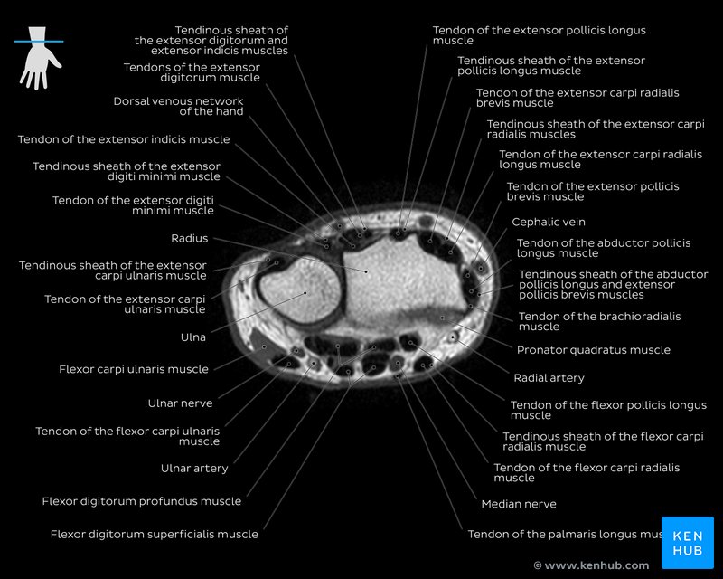 Mri Types Indications Contraindications Advantages Kenhub