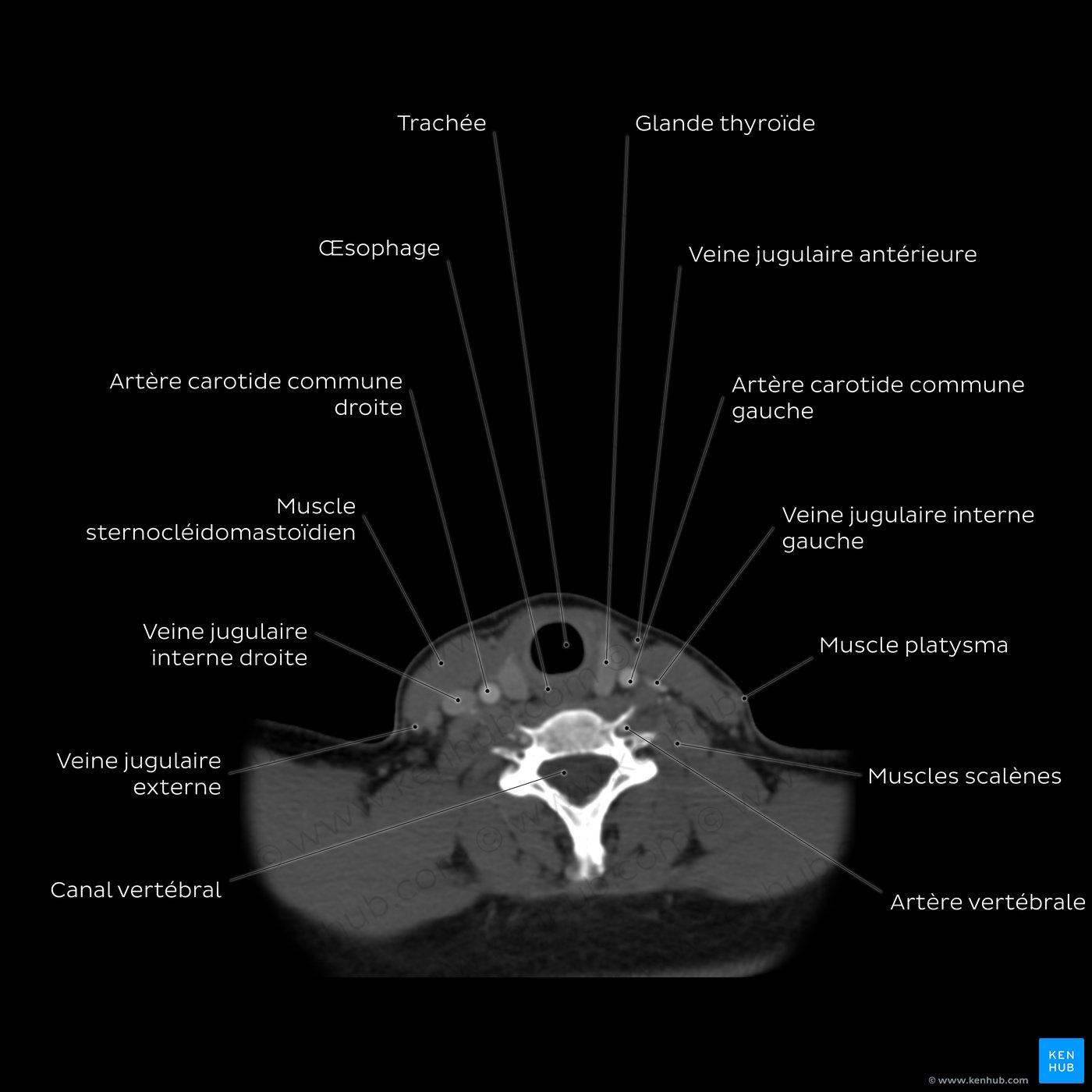 Anatomie radiologique : Radiographie, TDM, IRM | Kenhub