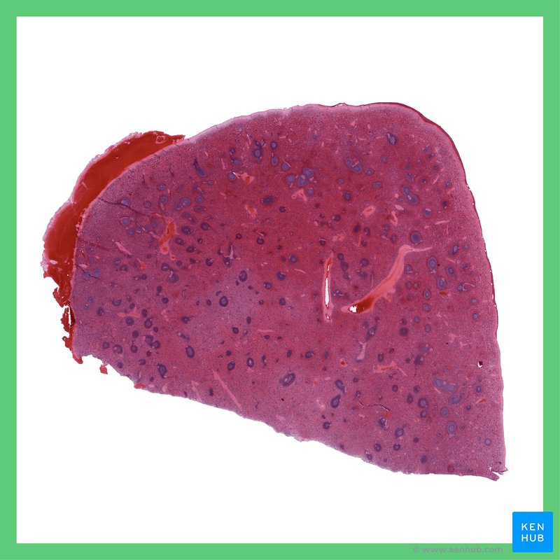 Histología del bazo: Ubicación, funciones, estructura | Kenhub