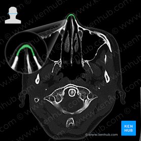 Nasal bone: Anatomy, borders, function, development | Kenhub