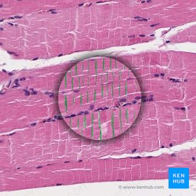 Tejido del músculo esquelético: Histología | Kenhub