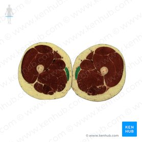 Gracilis: Origins, insertions, innervation and action | Kenhub