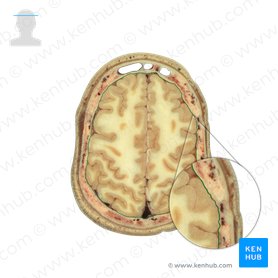 Dura: anatomy, function and features. | Kenhub