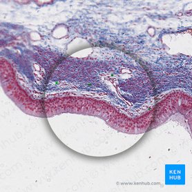 Linfócitos: Histologia, tipos e importância clínica | Kenhub