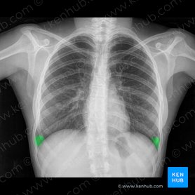 Pleural cavity: Anatomy, location, function | Kenhub