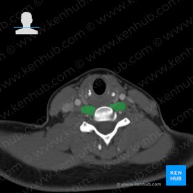 Longus colli muscle: Origin, insertion, actions | Kenhub