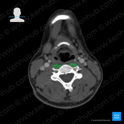 Prevertebral muscles, longus capitis muscle, anatomy | Kenhub