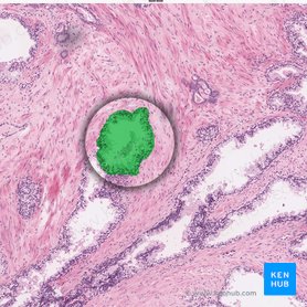 Próstata: Anatomía, histología y función | Kenhub