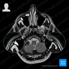 Orbicularis oculi: Origin, insertion and action | Kenhub