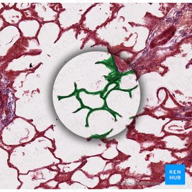 Capillaries: Continuous, fenestrated and sinusoidal | Kenhub
