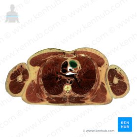 Anatomia seccional: secções transversais do corpo humano | Kenhub