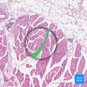 Skeletal muscle tissue: Histology | Kenhub