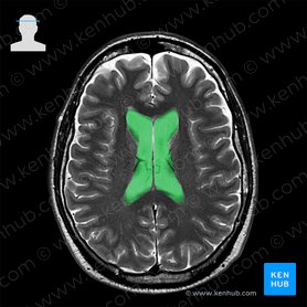 RM cerebral: Interpretación paso a paso | Kenhub