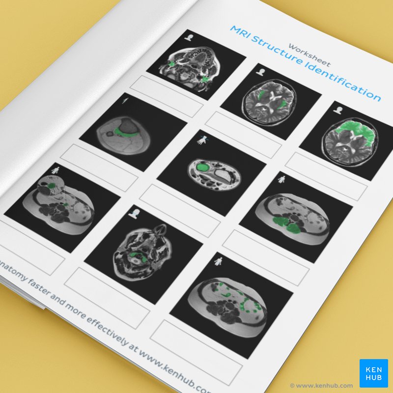 MRI study guide: Quizzes, test questions & flashcards | Kenhub