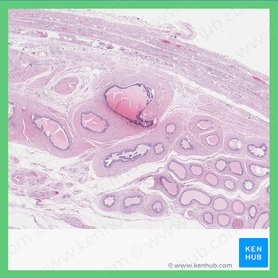 Epididimite - Causas, sintomas, tratamento, anatomia | Kenhub
