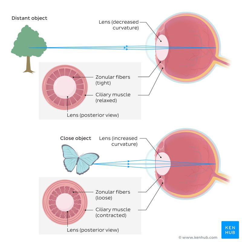 Refractive errors of the eye: myopia, hyperopia and more | Kenhub