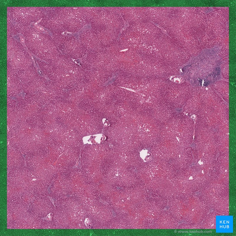 Liver histology: Structure, cells and characteristics | Kenhub