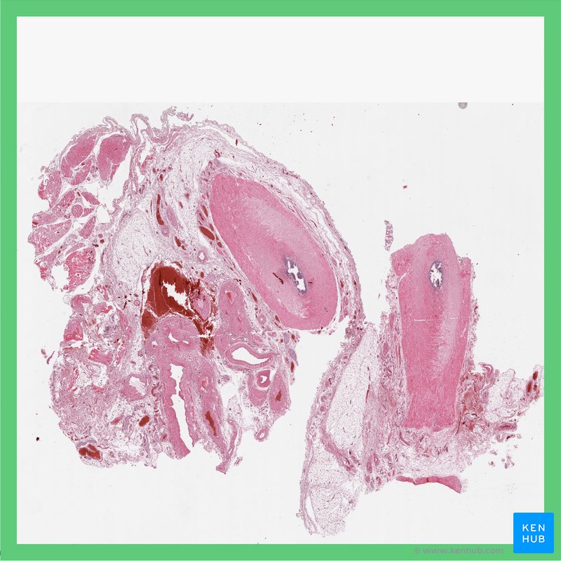 Funiculus spermaticus (Samenstrang) - Histologie & Aufbau | Kenhub