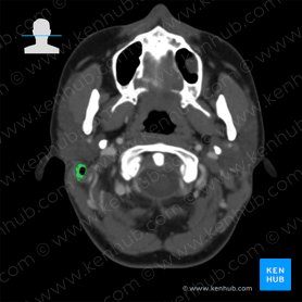 Mastoid process: Anatomy, function and attachments | Kenhub