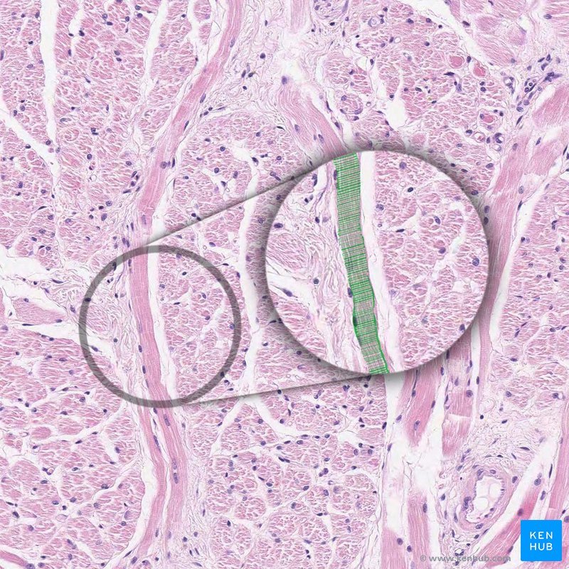 Skeletal muscle tissue: Histology | Kenhub