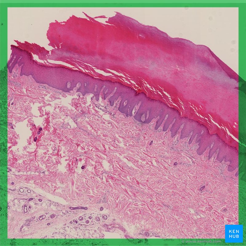 Epithelial tissue: definition, functions & examples | Kenhub