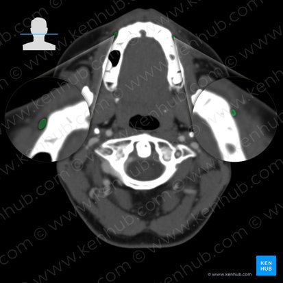 Cavidade oral - Anatomia, língua, músculos e inervação | Kenhub