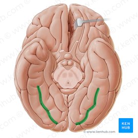 Lóbulo Y Corteza Temporal Anatomía Y Funciones Kenhub
