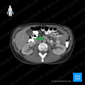 Pancreas: Anatomy, functions, blood supply, innervation | Kenhub