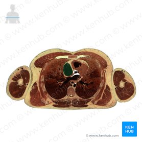 Heart (right and left atrium): Anatomy and function | Kenhub