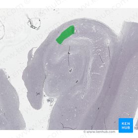 Hippocampus: Anatomy, functions and connections | Kenhub