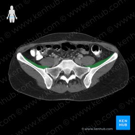 Iliacus: Origin, insertion, innervation, function | Kenhub