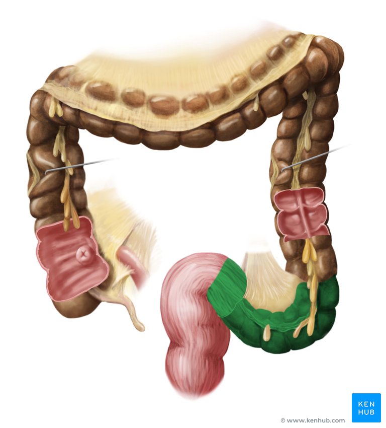 Sigmoid Colon Definition Anatomy And Function Kenhub