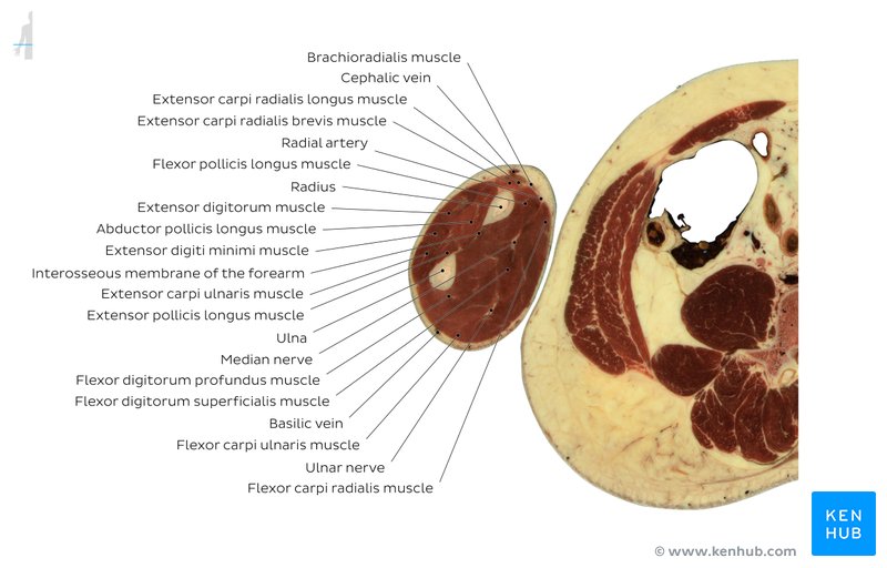 Cross sectional anatomy | Kenhub