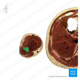 Humerus (Oberarmknochen) - Anatomie, Aufbau und Klinik | Kenhub