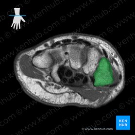 Trapezium bone: anatomy, function and features | Kenhub
