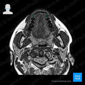 Canine tooth: anatomy, location and function | Kenhub