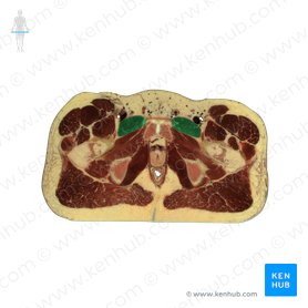 Pectineus: Origin, insertion, innervation, action | Kenhub