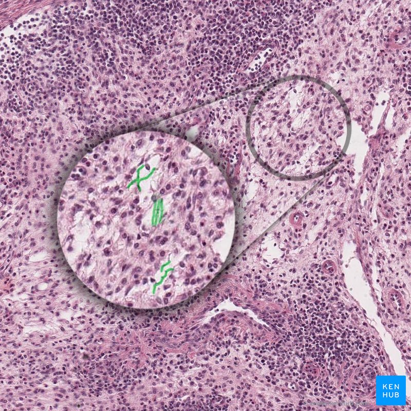 Reticular fibers: anatomy and histology | Kenhub