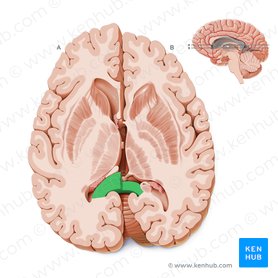 Corpus callosum: Anatomy, function and clinical aspects | Kenhub