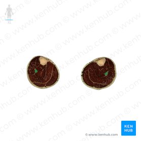 Fibula: Anatomy, bone landmarks and clinical aspects | Kenhub