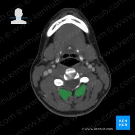 Multifidus: Origin, insertion, innervation, action | Kenhub