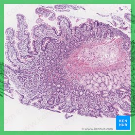 Duodenum: Anatomy, histology, composition, functions | Kenhub