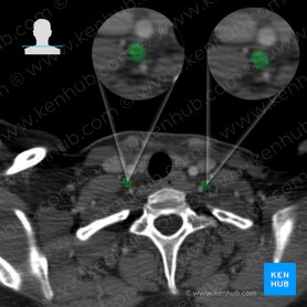 Vertebral vein: Course, tributaries, drainage area | Kenhub